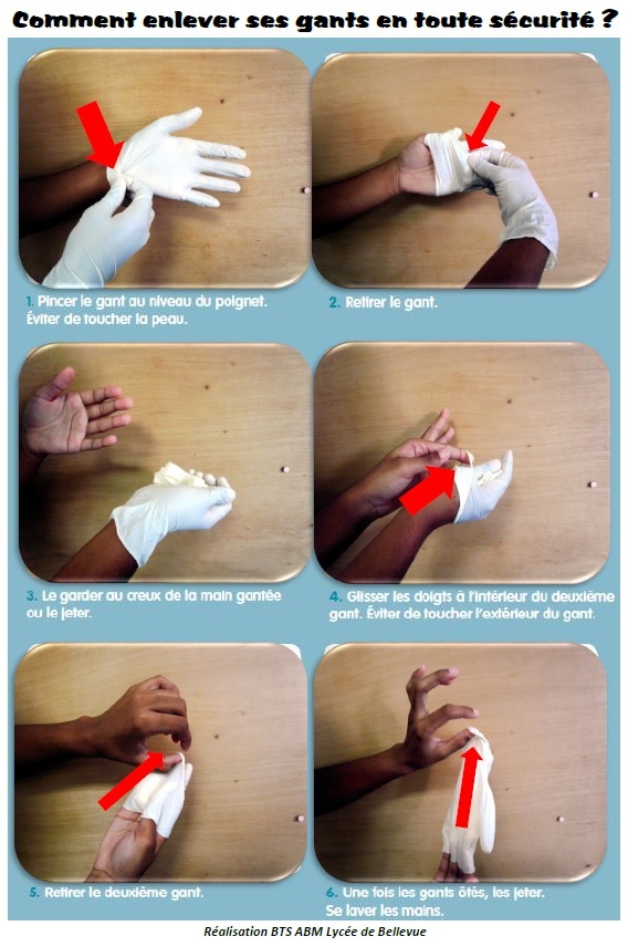 (SARS-CoV-2) COVID-19 : Protocole pour retirer des gants par les ...