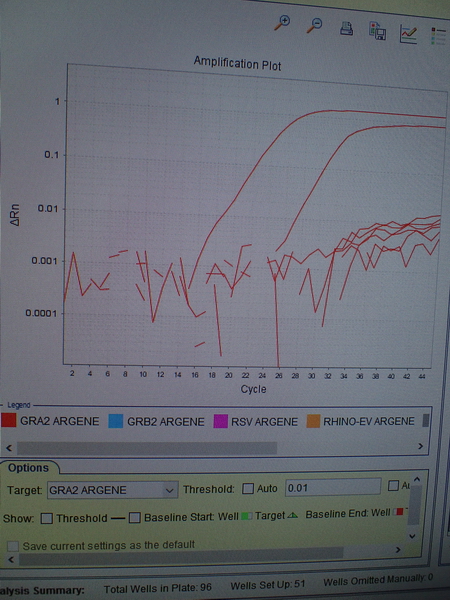 BTS ABM : journée découverte des secteurs du laboratoire du CHU ...